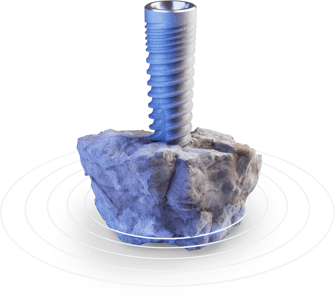 Discover Callus Implants - Callus Implants